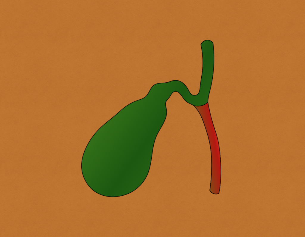 Ascending Cholangitis – SURGERY STUDENT