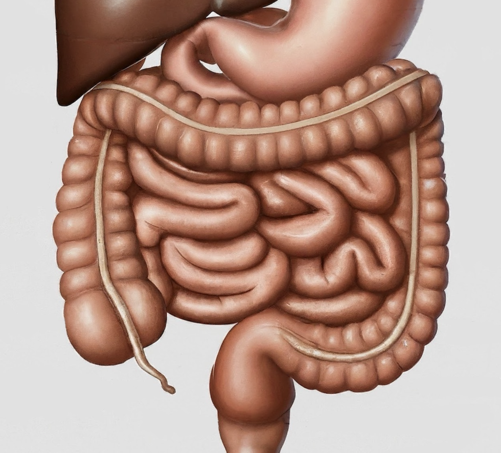 Inflammatory Bowel Disease – SURGERY STUDENT