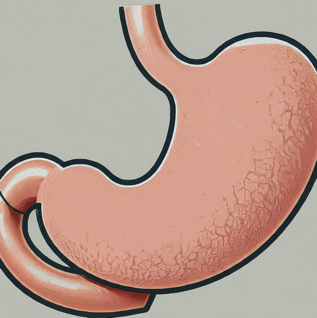 Zollinger-Ellison Syndrome – SURGERY STUDENT