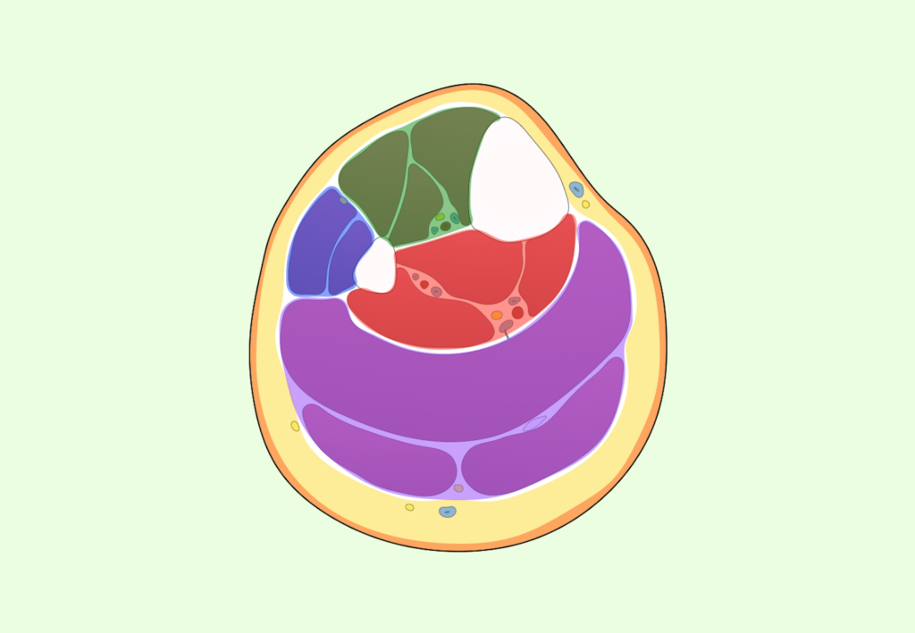 Acute Compartment Syndrome, leg – SURGERY STUDENT