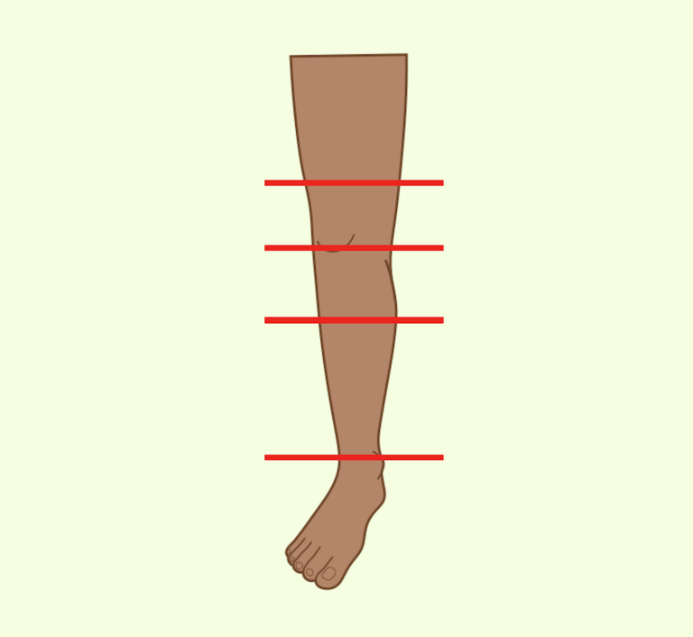 Lower Extremity Amputations – SURGERY STUDENT