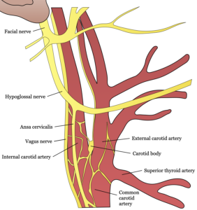 Carotid Endarterectomy – SURGERY STUDENT